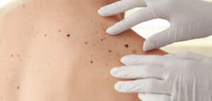 Services | Surgical Dermatology Group